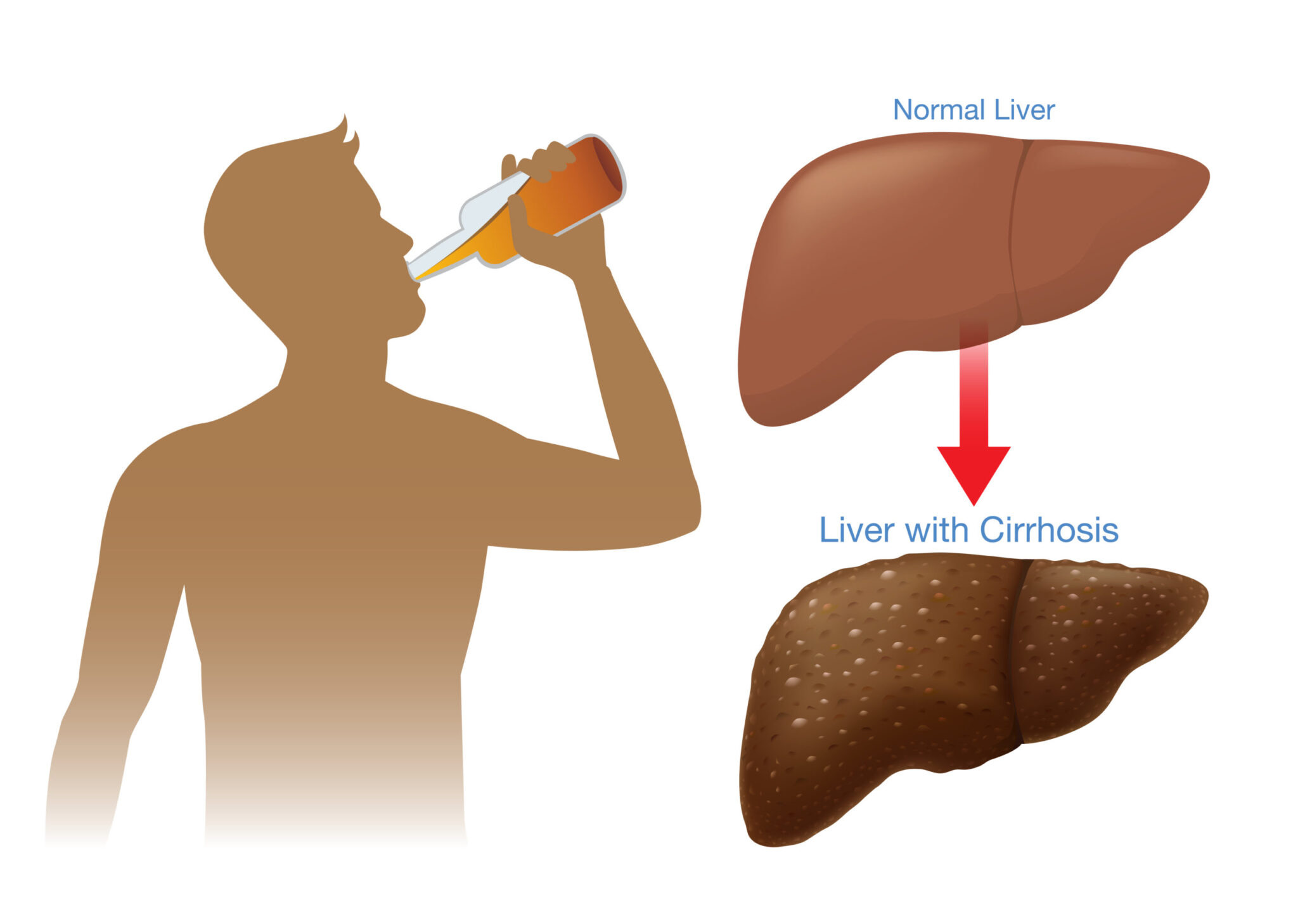 New Study Finds Pattern of Alcohol Intake More Accurate Indicator of ...